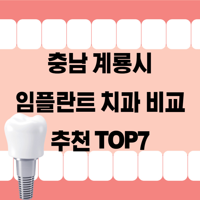 계룡시 임플란트 치과 잘하는곳 비교 추천 Top7 가격 저렴한곳 비용 싼곳 유명한곳