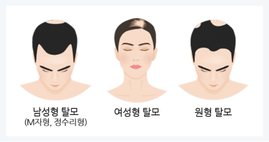 탈모에 대한 속설 과연 사실일까