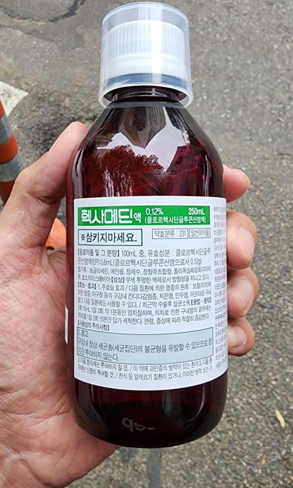 내돈내산 임플란트 후기 두번째 방문
