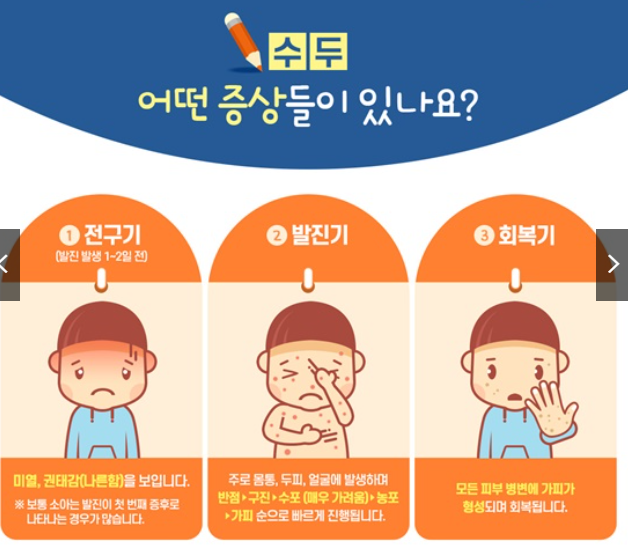 수두 증상 원인과 예방방법 및 치료법 정리