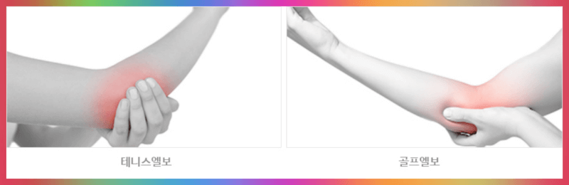 팔꿈치 찌릿 통증 테니스엘보 골프엘보 증상 원인 부작용 치료비용가격 치료잘하는 병원 팔꿈치 안쪽 바깥쪽 통증 치료