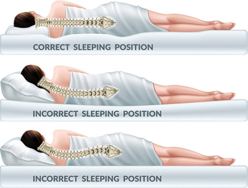 머리와 목 자세(head & neck posture)에 편한 베개(comfortable pillow)의 조건(condition)