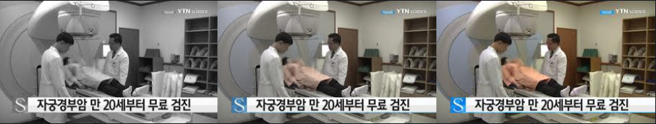 자궁경부암 무료검진 병원 조회하기