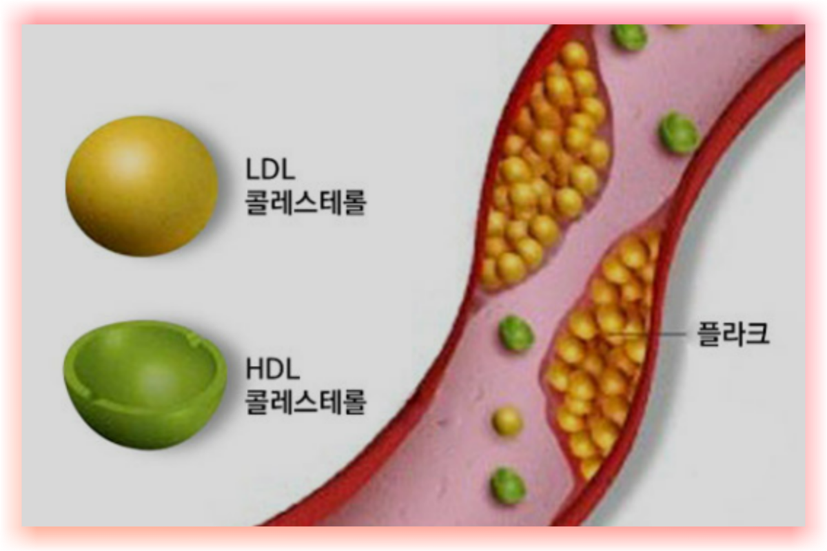 콜레스테롤 HDL과 LDL의 차이점 :: 찾았다