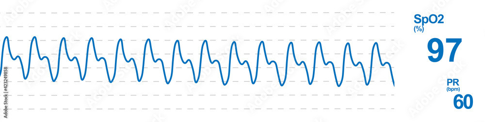 산소포화도 Sp02 및 산소분압 Pa02란?