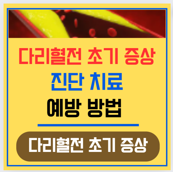 다리혈전 초기 증상 진단 치료 예방 방법