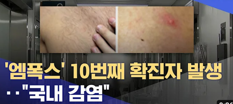 엠폭스mpox 원숭이두창 뜻 원인 증상 치료 백신 치사율 전파 감염률 감염경로 알아보기