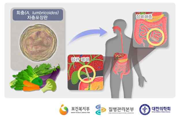 공중보건 미용학 미용사 일반 등 소독법과 전염병학 요점 정리 46 기생충 감염병