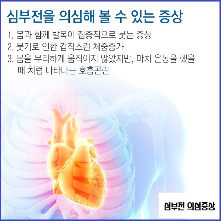 심부전 증상과 원인 치료법까지 총정리