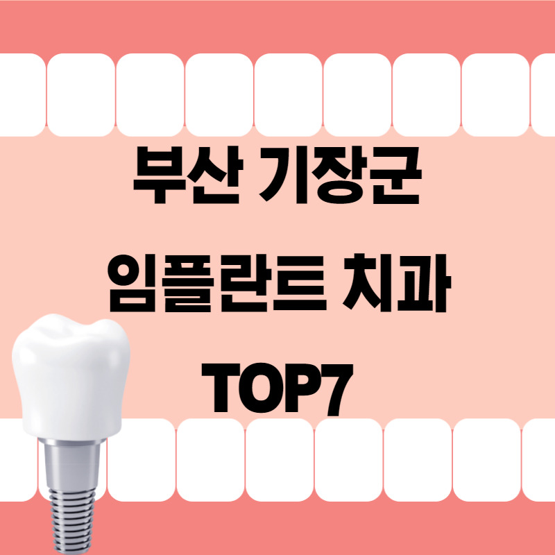 부산 기장군 임플란트 치과 잘하는곳 추천 Top7 가격 저렴한곳 비용 싼곳 유명한곳