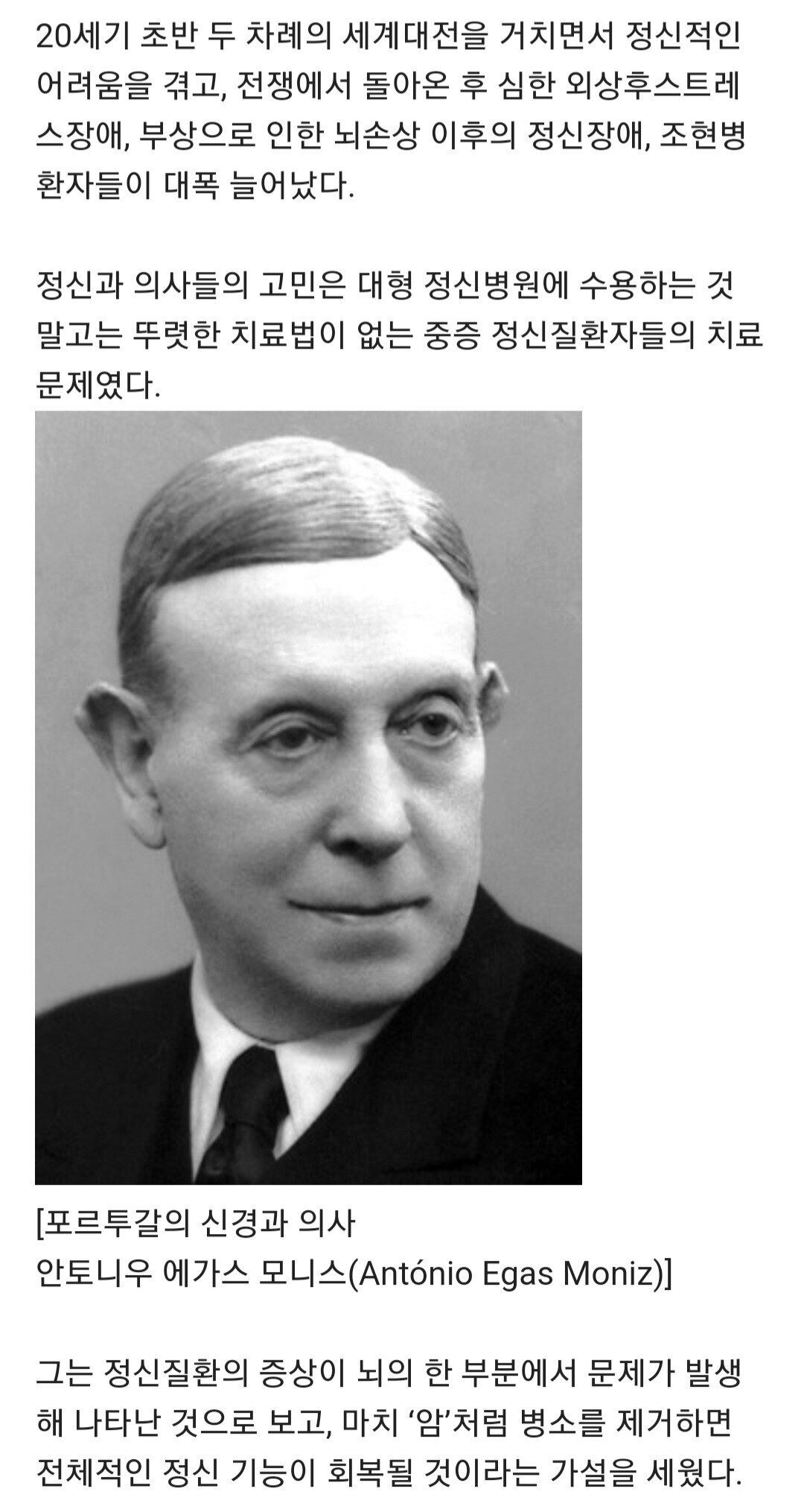 미국 대통령 케네디의 여동생을 중증 장애인으로 만든 뇌수술 끔찍한 전두엽 절제술
