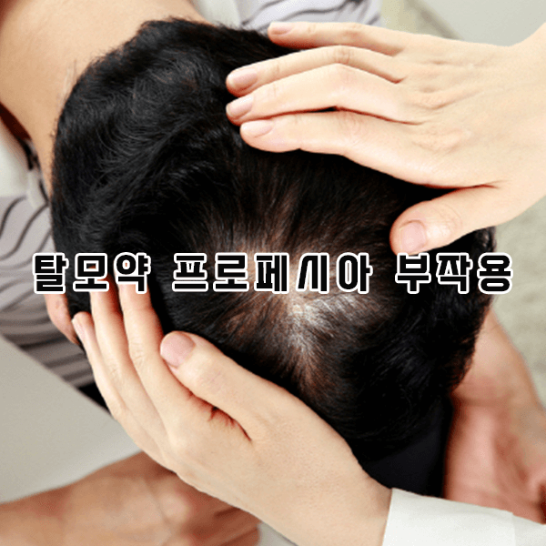 탈모약 프로페시아 부작용과 올바른 복용방법feat솔직후기
