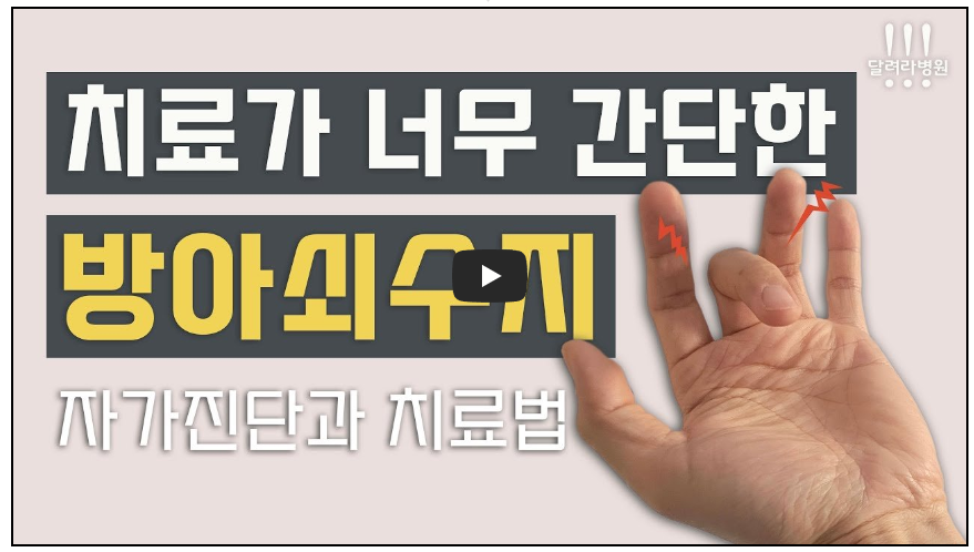 방아쇠 수지 증후군 치료 간단하게 하는법