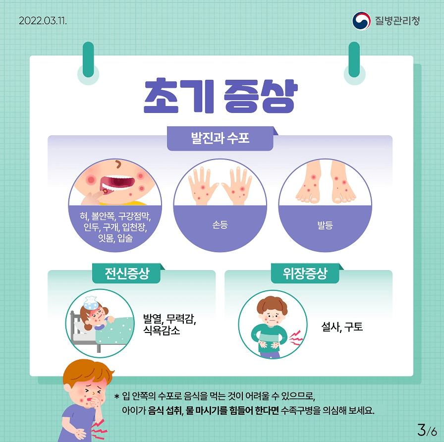 수족구 증상 및 예방 조치 및 치료