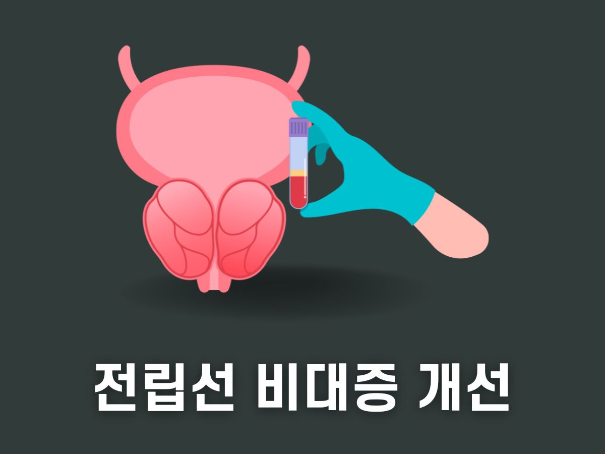 카리토포텐 가격 효능 부작용 복용법