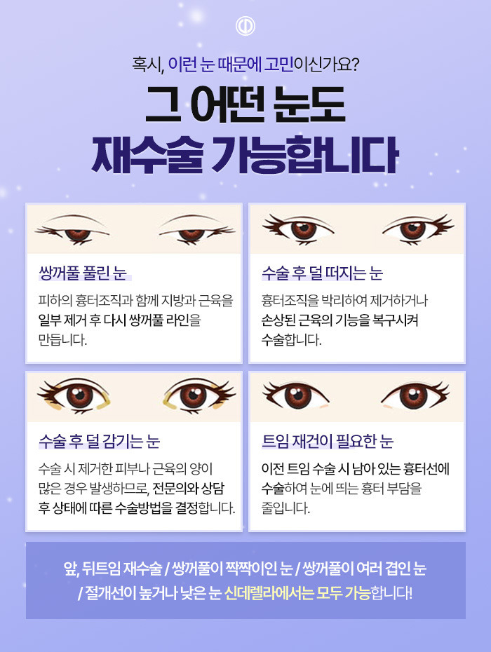 강남성형외과추천 유명한곳 재수술 잘하는곳 찾는다면은