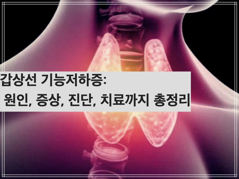 갑상선 기능저하증 원인 증상 진단 치료까지 총정리 건강 정보