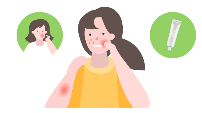 농가진 증상 원인 전염 치료방법 총정리 예방법