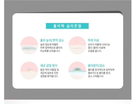 제왕절개 흉터 치료 수술후 관리 폴리텍 실리콘겔