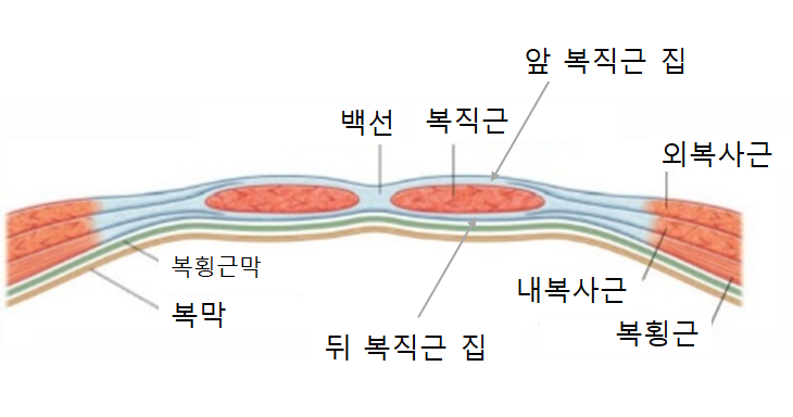 전주 이진복한의원 복부근육복근에 대해