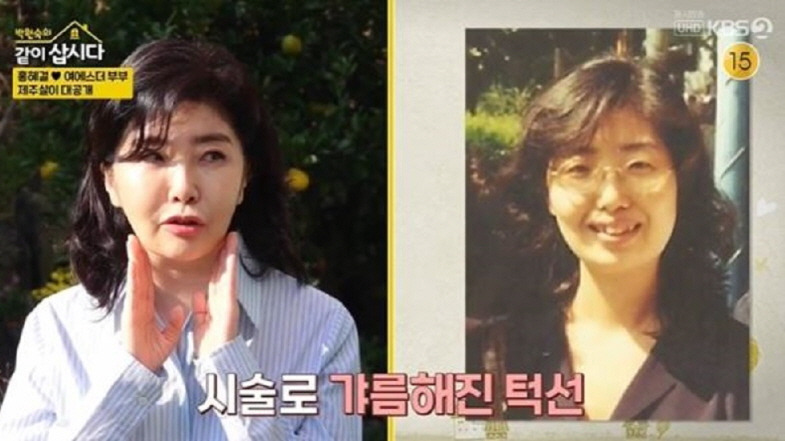 의사 여에스더 남편 홍혜걸 프로필 나이 학력 고향 자녀 가족 과거사진 리즈 본명 여에스더 프로필 근황