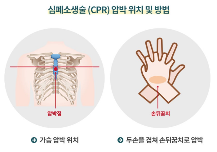 심폐소생술cpr 방법 그림 설명서 첨부 영유아 실시 방법 및 주의사항