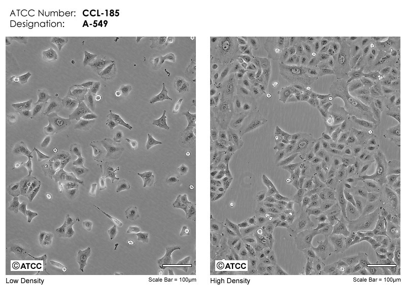 [동물 실험_세포] A549 cell properties : Human epithelial cell (A549 세포 특성 정리)