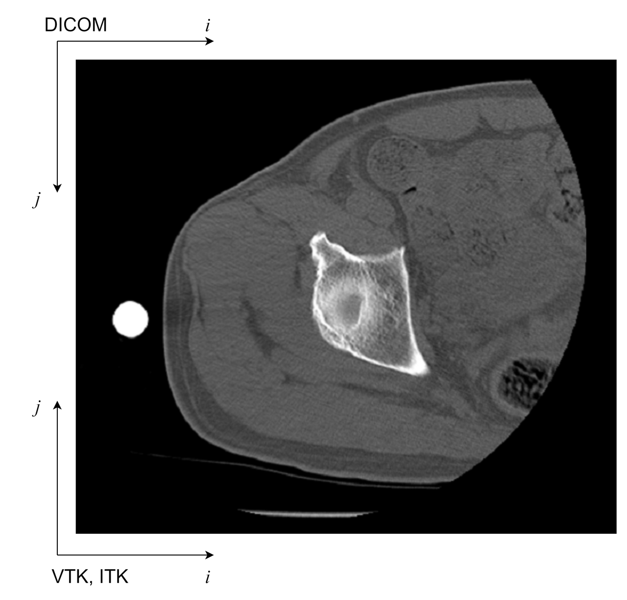 의료영상 좌표시스템 in CT, DICOM, Vtk, Itk — 로봇을 품은 개발자 이야기
