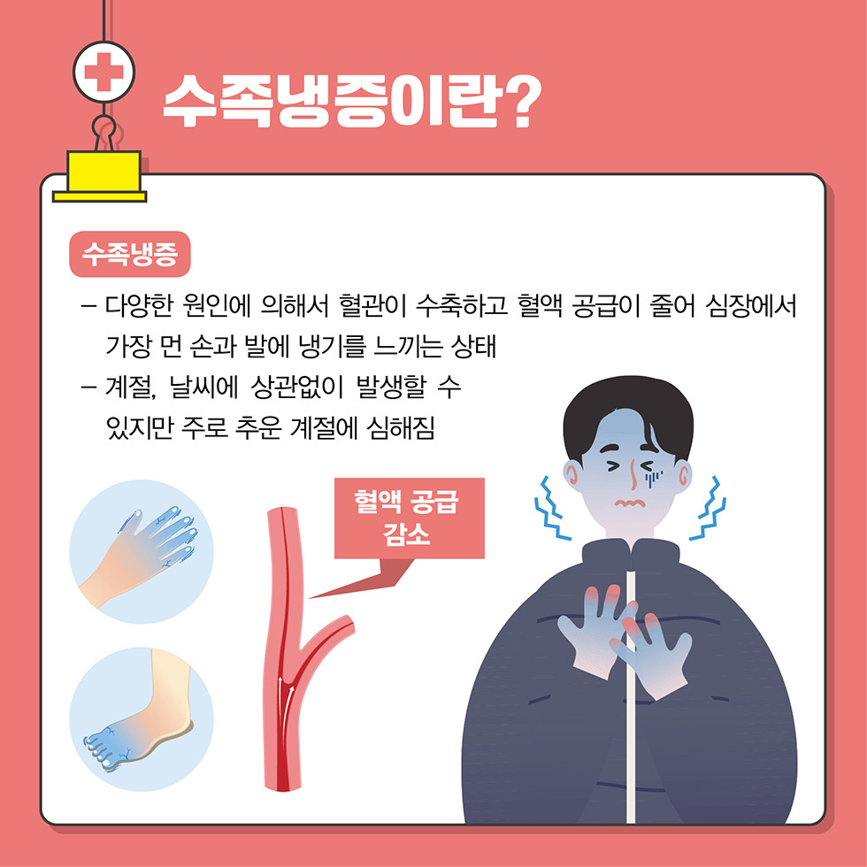 겨울철 손발시림이 더욱 심해지는 수족냉증 증상과 치료법 건강 쉼표