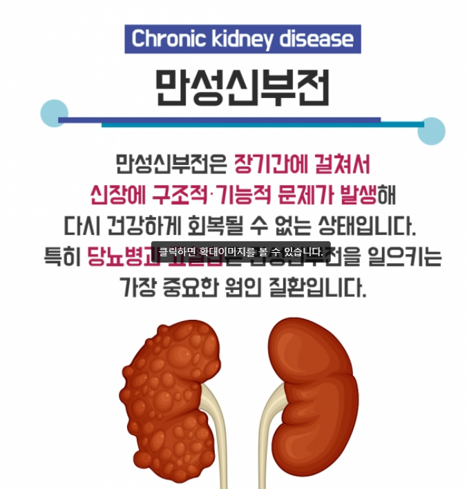 신부전증 증상 원인 치료방법 병원