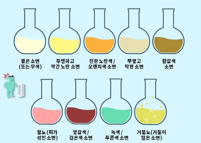 소변 색깔이 노란색 색깔로 보는 건강