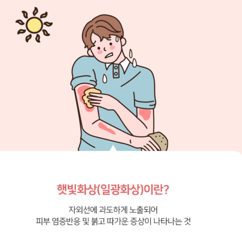 여름 뜨거운 햇빛일광과 햇빛 화상 정리 및 응급처치 건강 쉼표