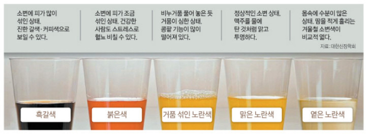 소변 색깔이 노란색 색깔로 보는 건강