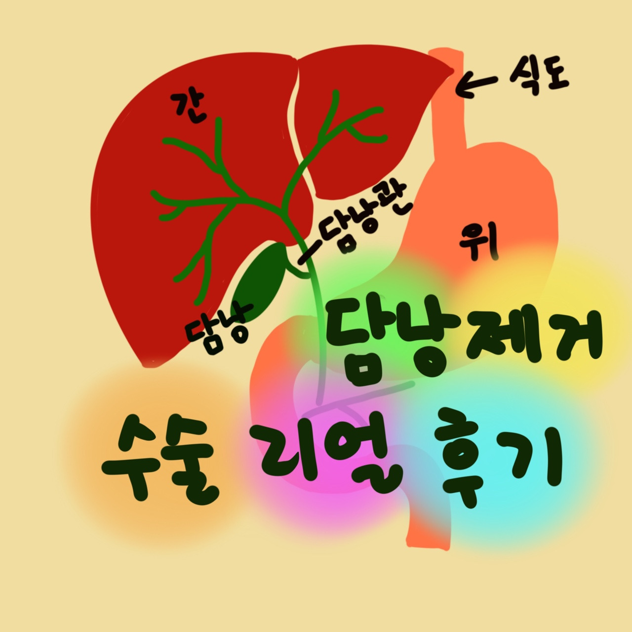 담낭제거수술 비용 후유증 통증 음식 병원 3달차 솔직후기