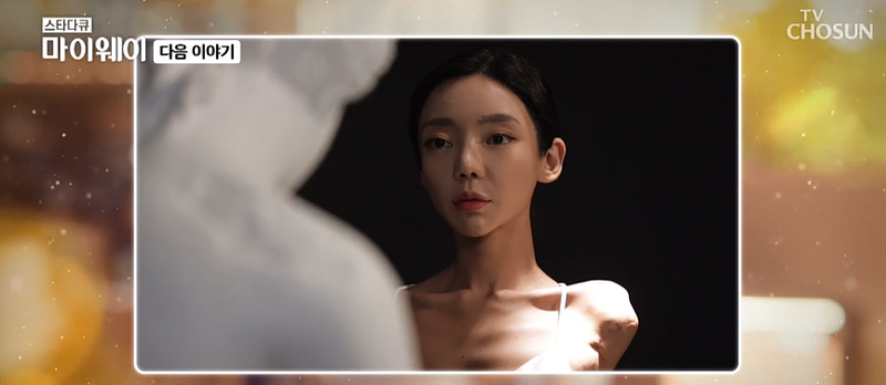김나윤 나이 한 팔 사고 피트니스선수 스타다큐 인스타그램 세상에이런일이