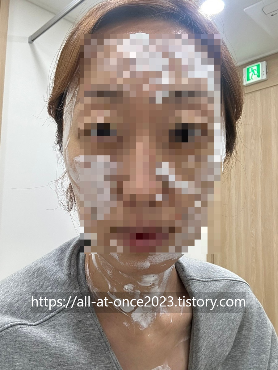 편평사마귀 레이저 제거 후기 자연튼튼 의원