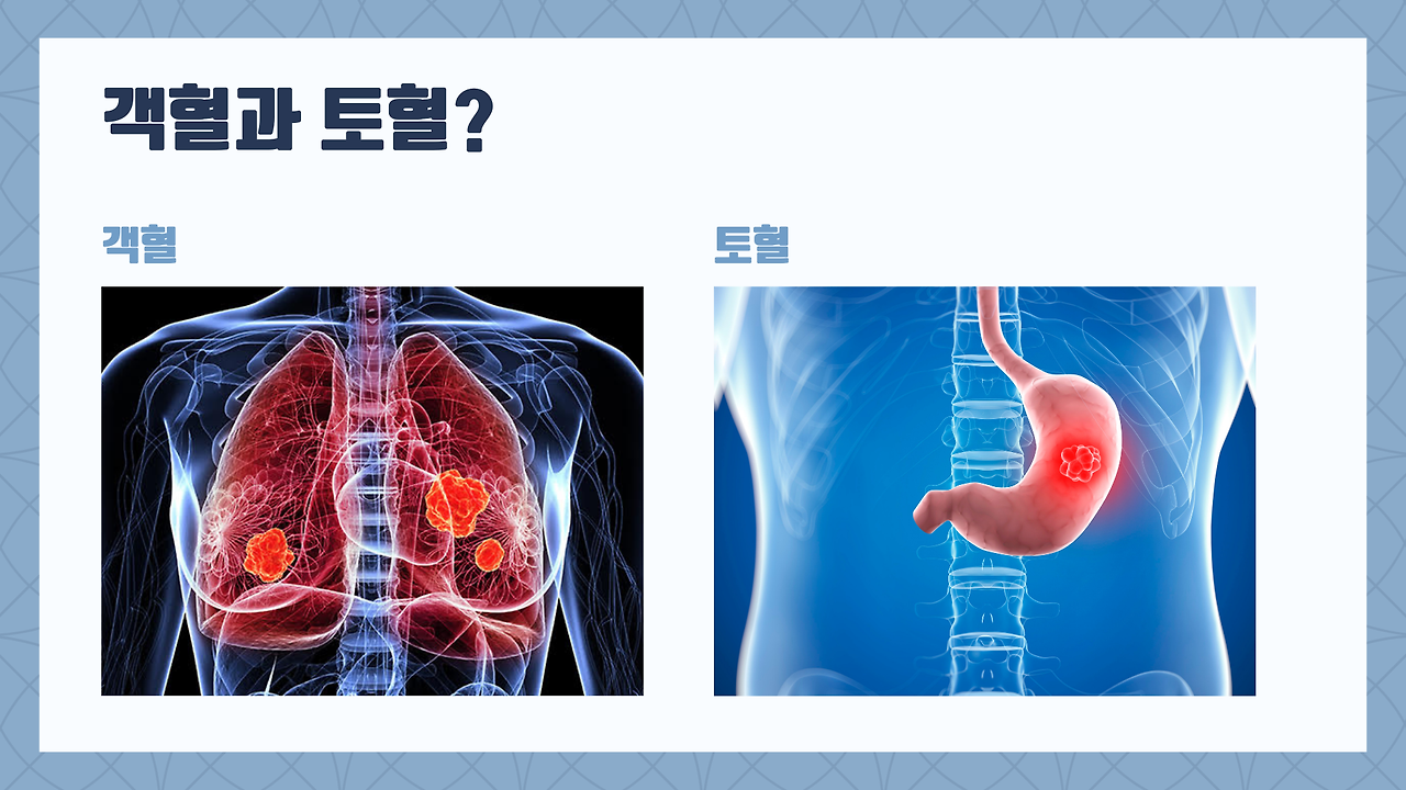 가래에서 피가 섞여 나와요 피가래 객혈 6가지 원인과 해결방법 예방법 알아보기