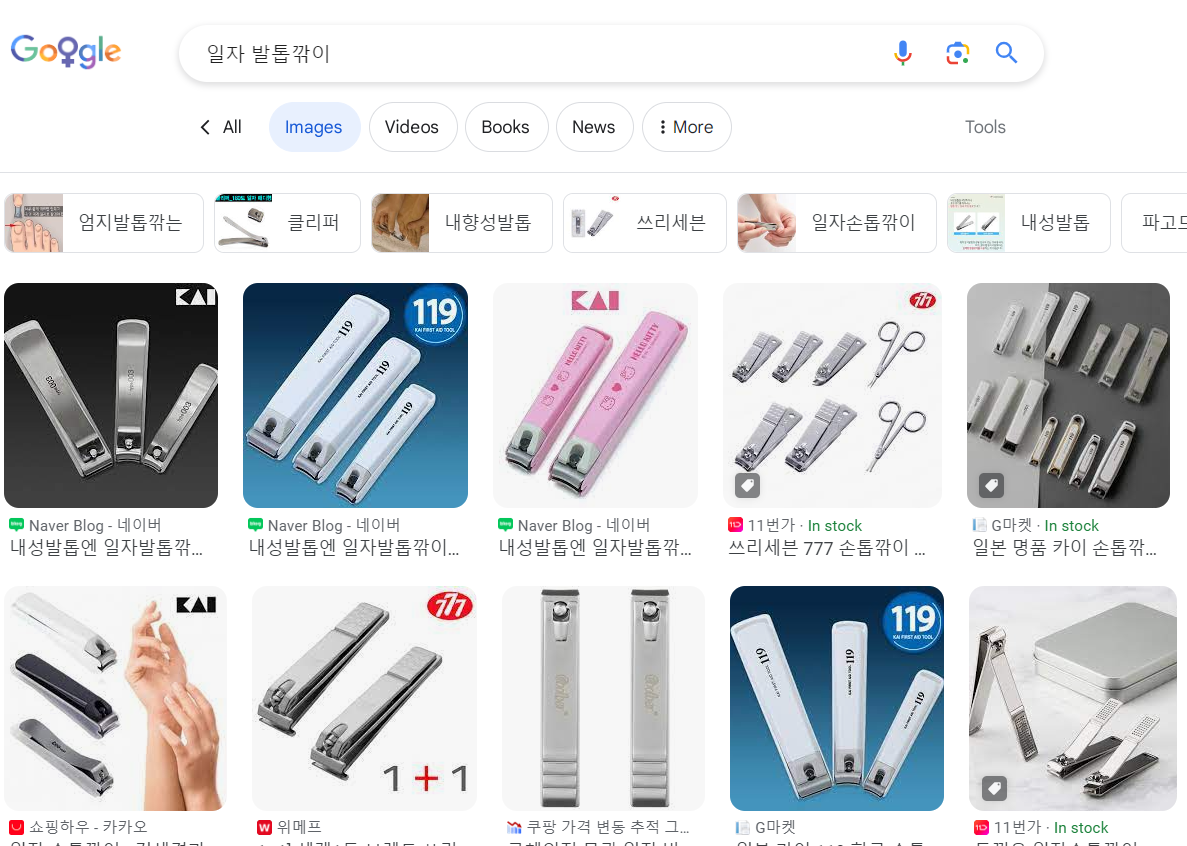 정형외과전문의 족부질환 내성발톱 내향성발톱 어떻게 치료하나요