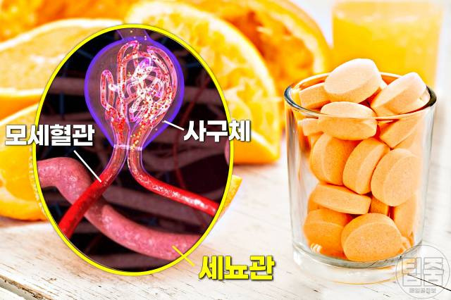 신장에 나쁜 영양제 약 5가지 비타민 과다복용 하루권장량 지키세요