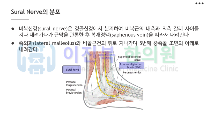 전주 이진복한의원 비복신경 포착증후군