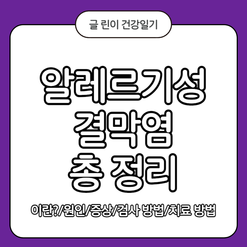 알레르기성 결막염 총 정리