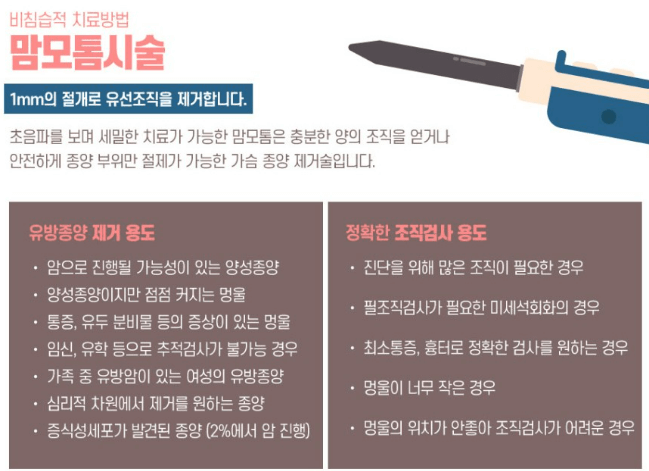 맘모톰 수술 비용 실비 맘모톰 후기유방 섬유선종 머니왕 코주부