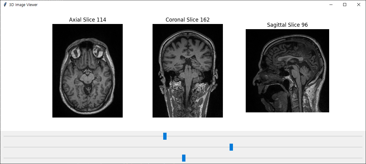 3D array DICOM으로 axial, coronal, sugittal view만들기 :: 개발 아카이브