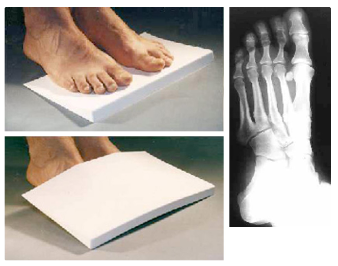 Foot AP projection, 발 AP, axial 촬영법