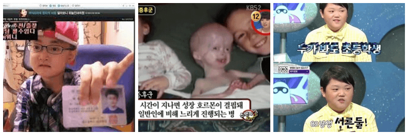 늙지 않는 병 하이랜더 증후군 원인과 실제 사례들배우들과 Bj