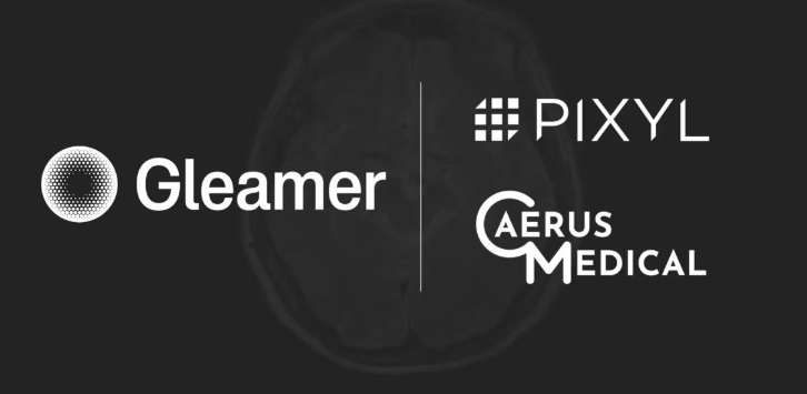 AI로 의료 이미징 혁신을 이끄는 Gleamer의 도전과 비전