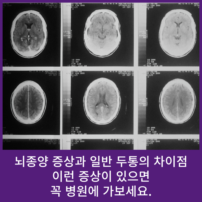 뇌종양 초기증상 과 편두통 차이점