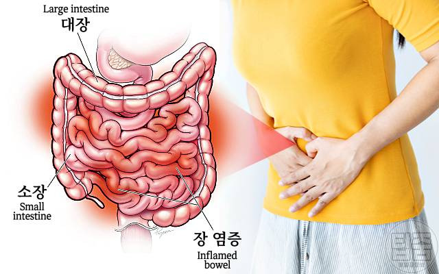 장염에 좋은 음식 6가지 장염에 좋은 죽 장염 빨리 낫는 법