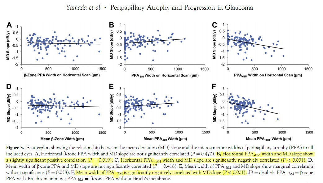 유두주위 맥락망막위축, Peripapillary atrophy, PPA 와 노년성경화, Senile sclerosis