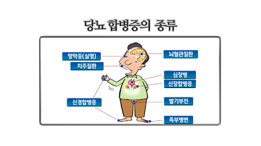 당뇨 합병증 종류